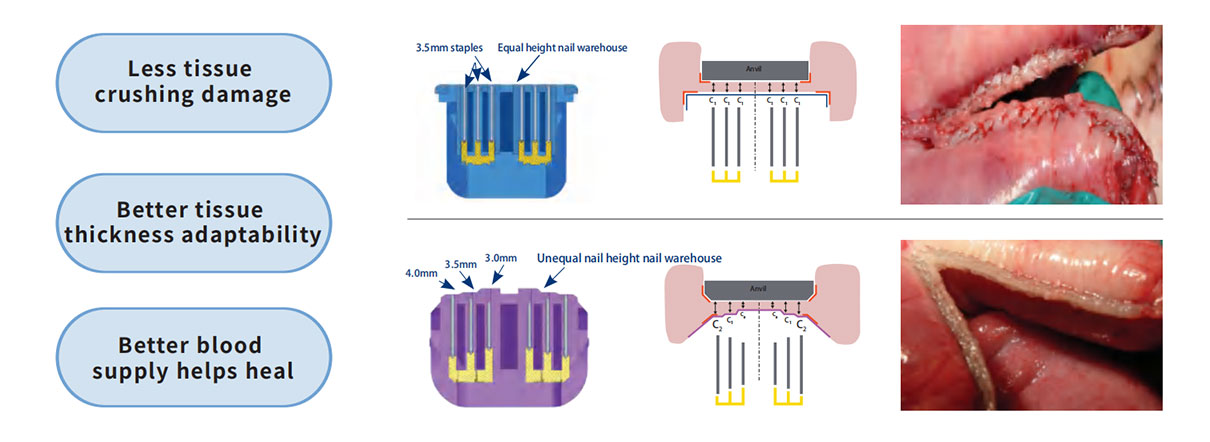 Disposable Endo Linear Cutter Stapler and Reloading Unit - Changzhou ...